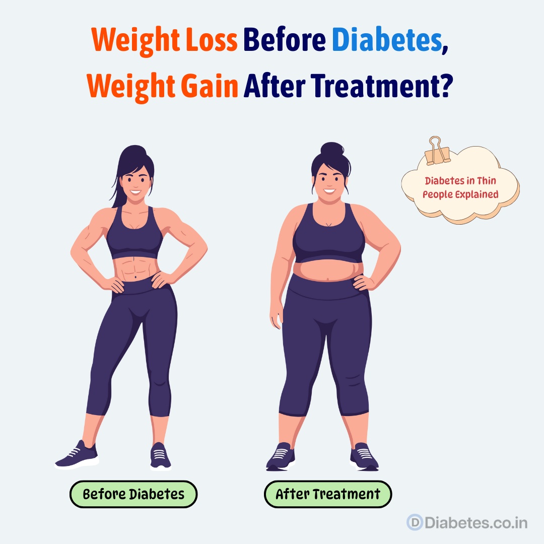 Weight Loss Before Diabetes, Weight Gain After Treatment? Diabetes in ...